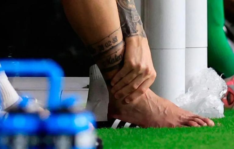 Las impactantes imágenes del tobillo de Messi luego de la lesión en la ...