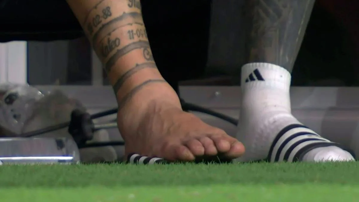 Las impactantes imágenes del tobillo de Messi luego de la lesión en la ...